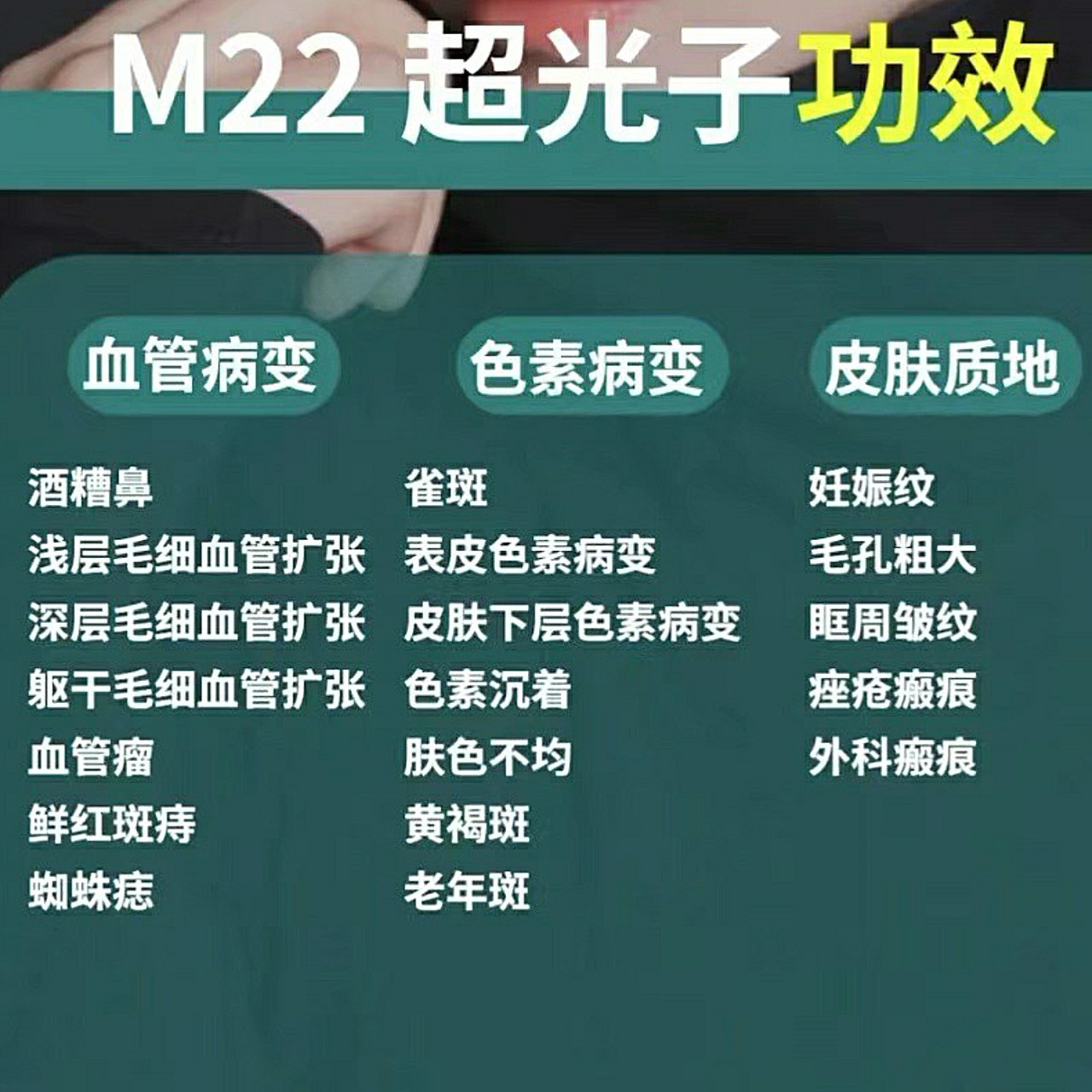 M22/AOPT超光子嫩肤一机多功效解决肌肤问题。_圈子-新氧美容整形